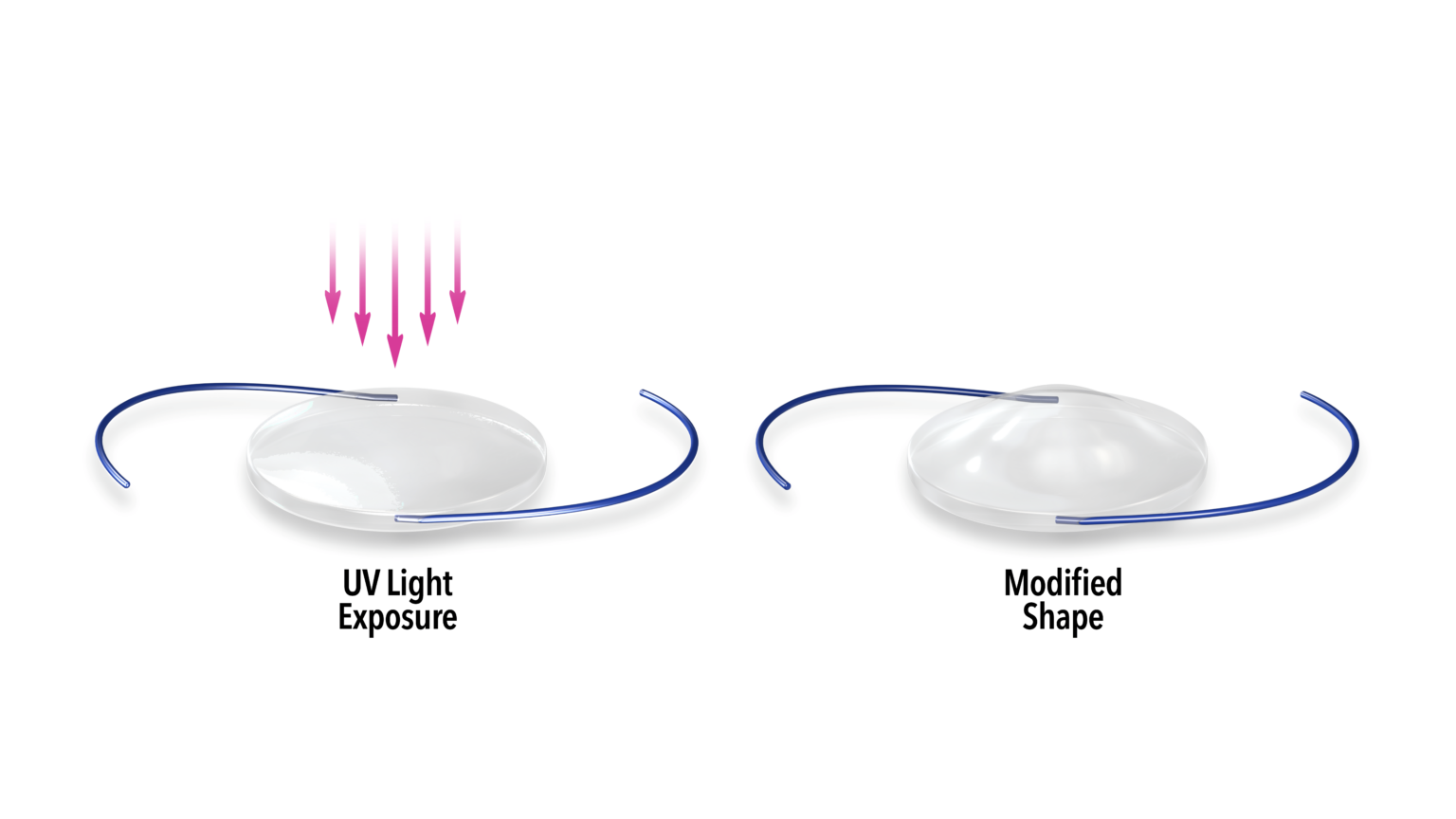 10 FAQs About RX Light Adjustable Lens - Your Guide to Advanced ...
