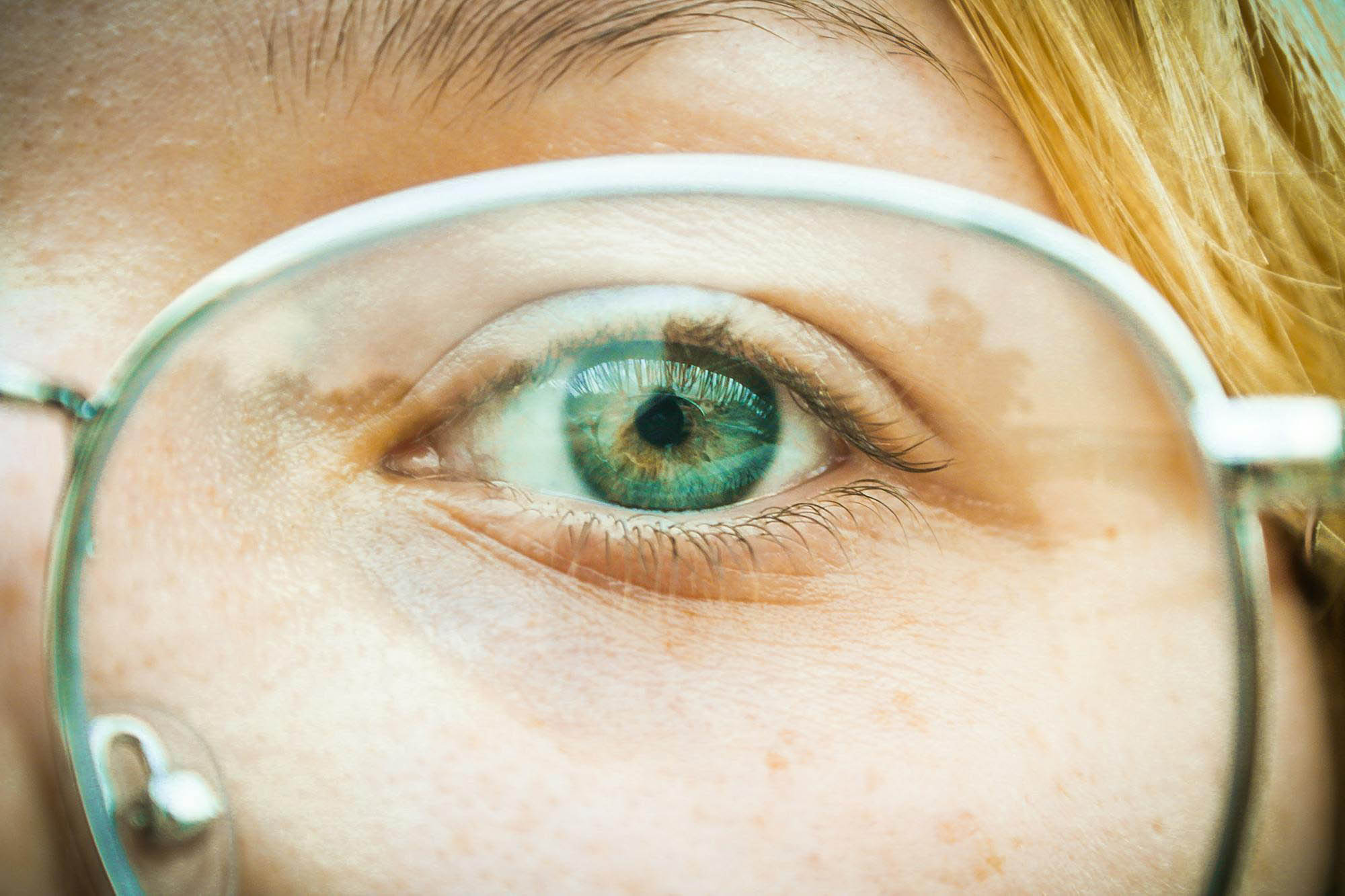 Understanding Myopia | Causes & Symptoms Of Nearsightedness
